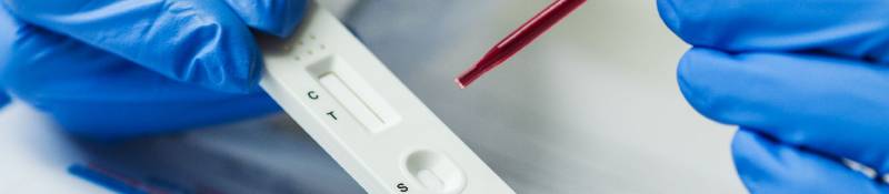 Lateral Flow Assays: Principles, Designs and Reagents | Leinco