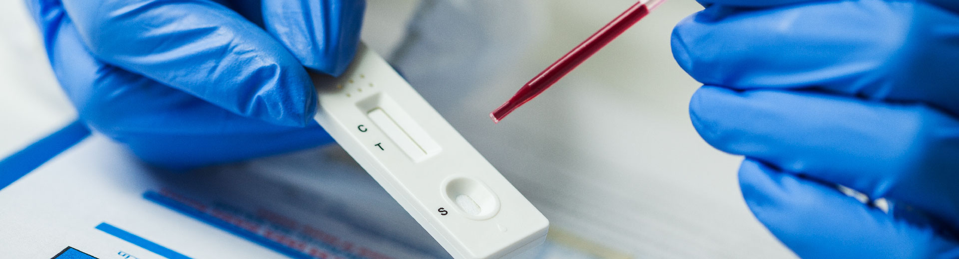Lateral Flow Assay Development - Leinco Technologies Lateral Flow Assay Development - Leinco Technologies
