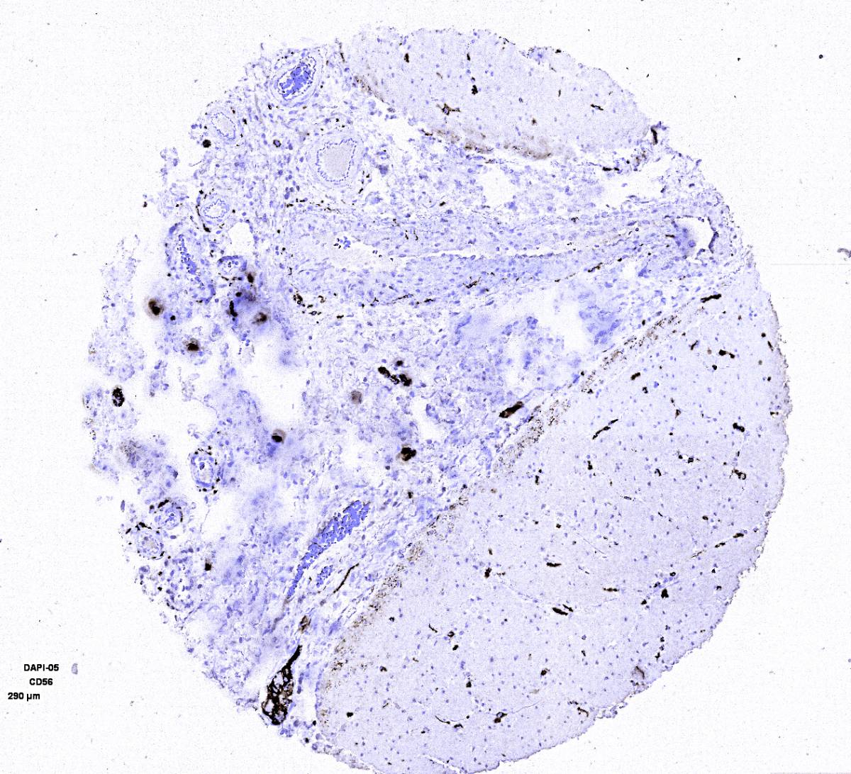 Immunohistochemistry Reagents | Leinco Technologies